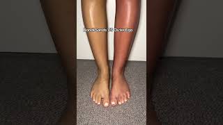 Outer ego VS Bondi sands ???????????? which do you prefer? Results up next #outerego #tanningthursday