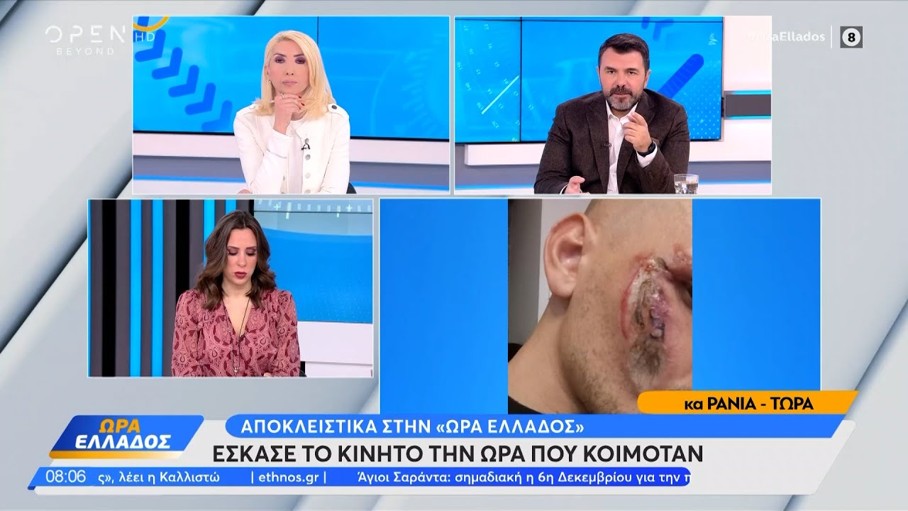 Ελλάδα: Εξερράγη κινητό κατά την φόρτιση! Σοβαρά εγκαύματα ο ιδιοκτήτης - Techmaniacs