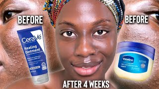 I USED VASELINE/CERAVE HEALING OINTMENT ON MY FACE EVERYDAY FOR 4 WEEKS | I’M SOO SHOCKED 😱🤭💦