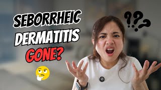 Seborrheic Dermatitis on face? This Is the Only Fix That Works!