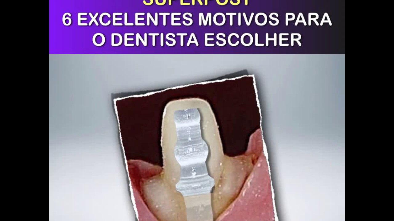 Superpost Cement + – Superdont