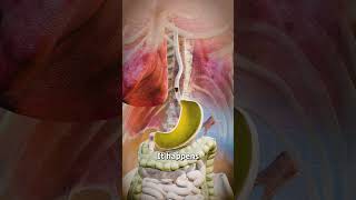 Acid Reflux Explained π€