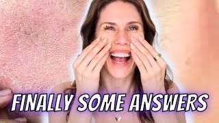 How to find the Best Moisturizer for YOUR Skin Type