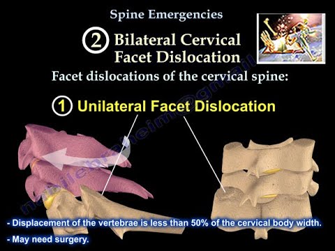 Spine Emergencies – Dr. Nabil Ebraheim's Blog