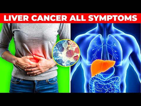 How to Identify Liver Cancer: Key Signs and Symptoms – Trade Gheenyuz