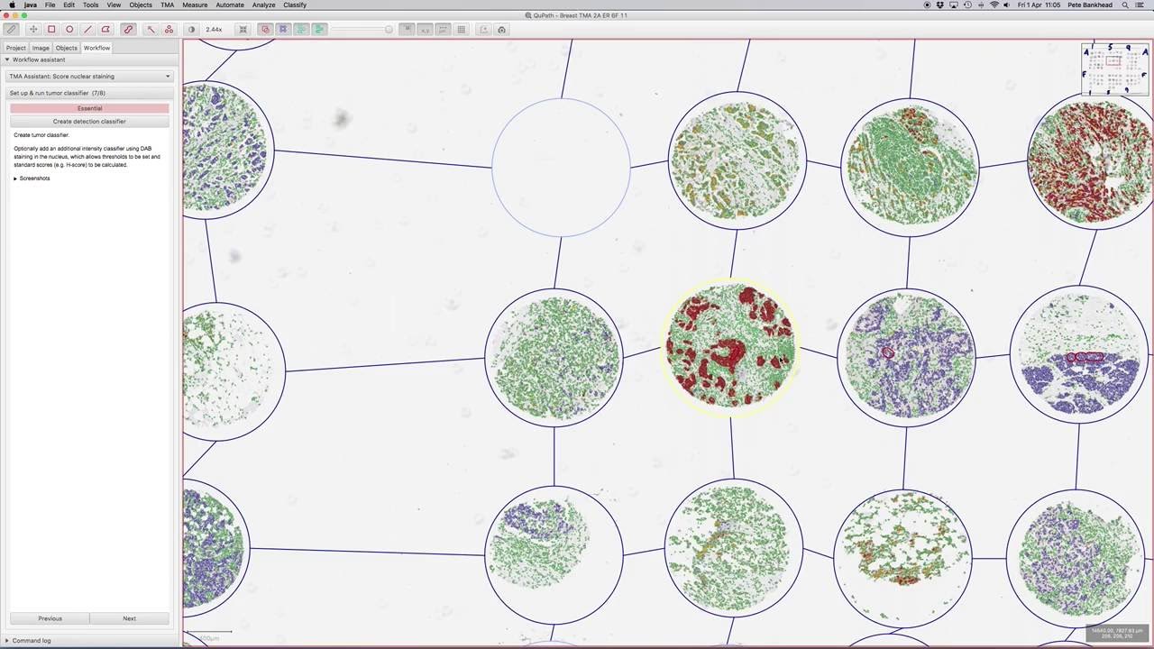 TMA ER analysis · qupath/qupath Wiki · GitHub