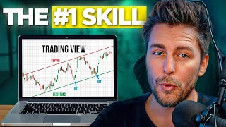 Dynamic Risk Management The #1 Skill Traders Never Learn