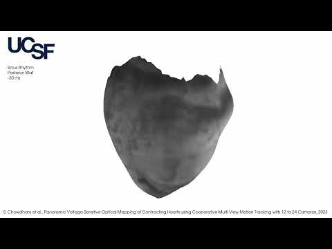 Videos | Cardiac Vision Laboratory