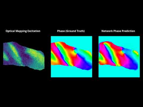 Videos | Cardiac Vision Laboratory