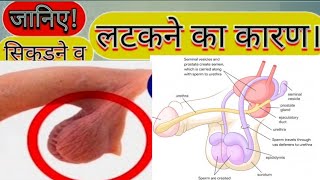 अण्डकोष क्यों लटकते हैं|andkosh kyon latkte hain|andkosh|purush jannang|facts|vk4.0 fact|new facts|