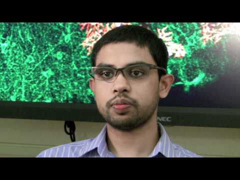 Picture from the cerebellum – Praneeth Namburi