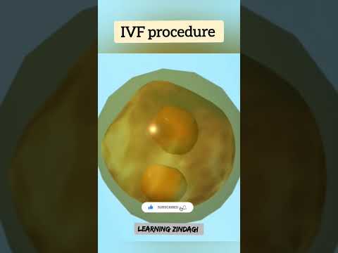 IVF procedure in 3d animation#shorts #short #shortvideo #shortsfeed #humanbody #3d #3danimation