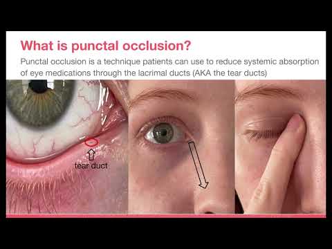 Punctal Occlusion