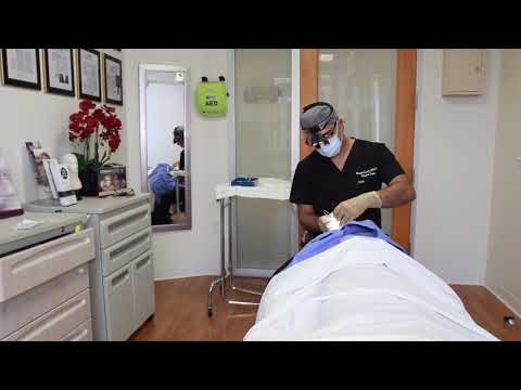 Punctal Canalicular Stenosis Beverly Hills