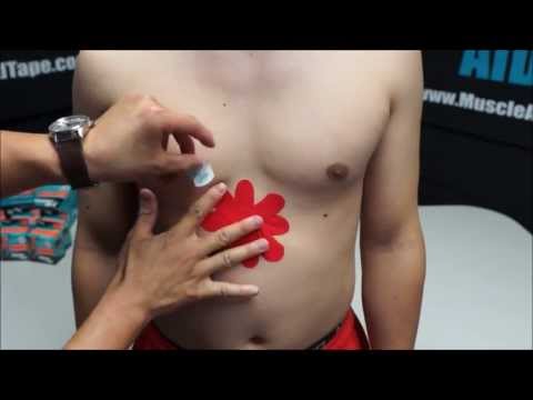 MuscleAidTape: Indigestion