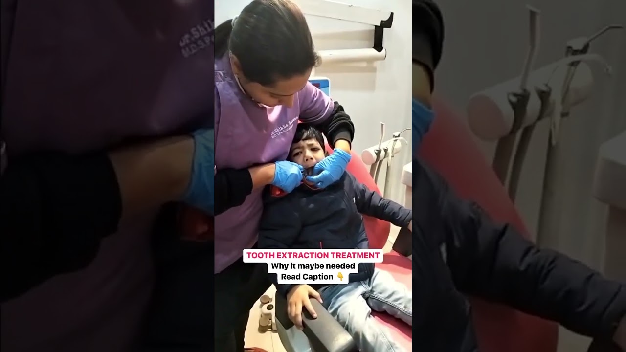 Tooth Extraction Treatment for Kids (Safe & Easy)