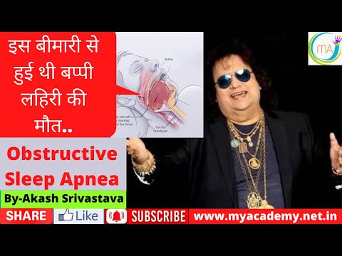 Obstructive Sleep Apnea by Akash Srivastava