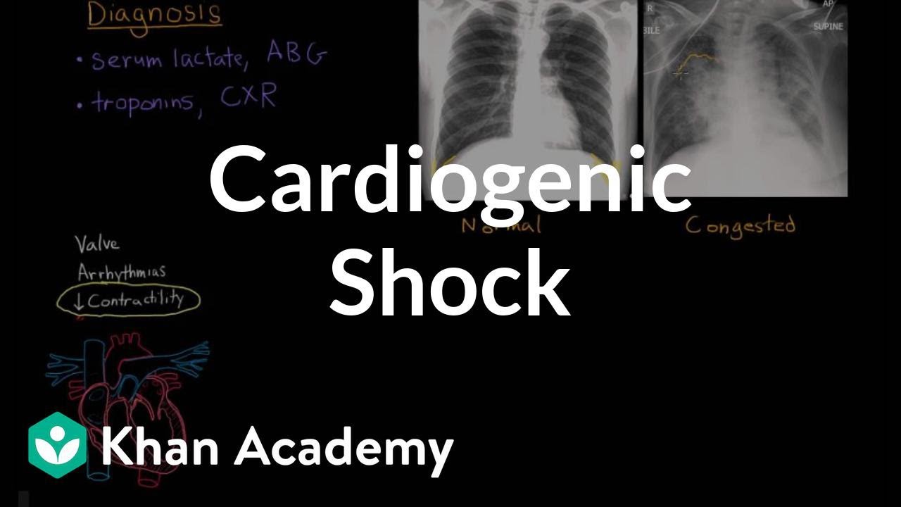 Cardiogenic shock | Circulatory System and Disease | NCLEX-RN | Khan Academy