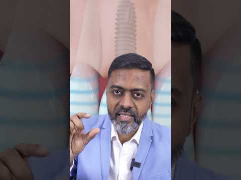 Restoring Smiles, Restoring Lives: The Wonders of Dental Implants