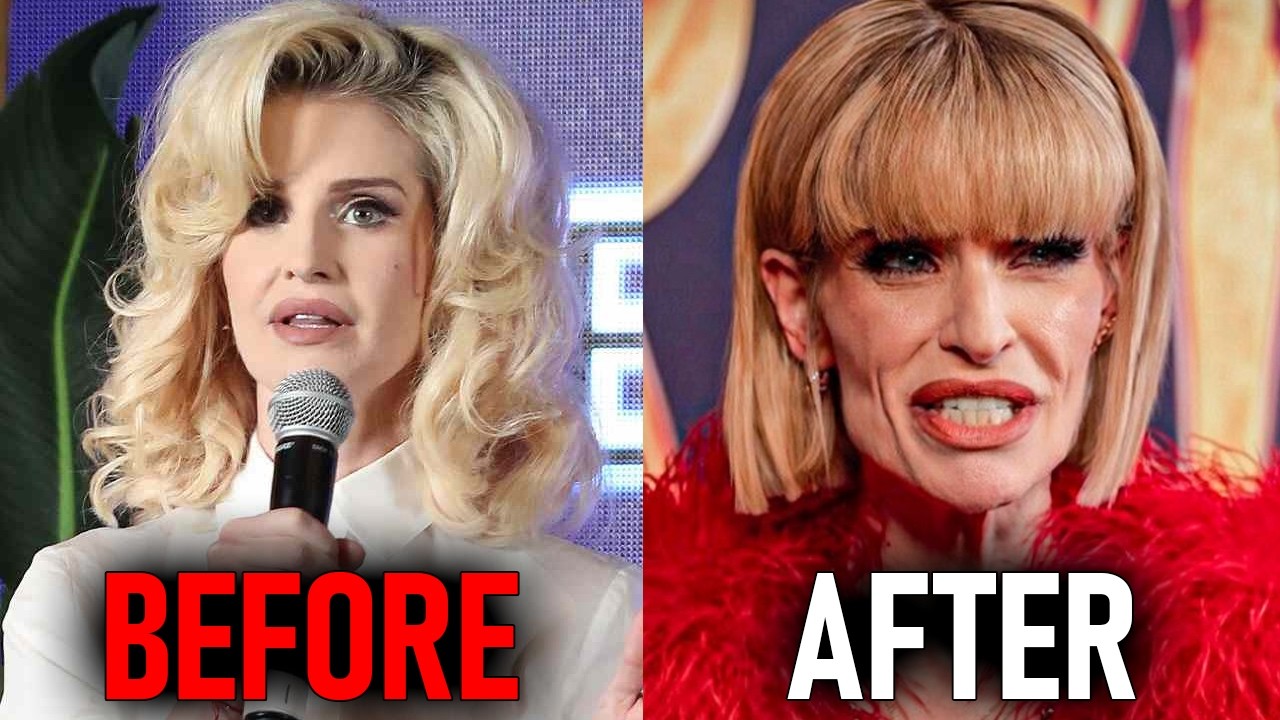 Before and After Photos Of Celebrities With Ozempic Face