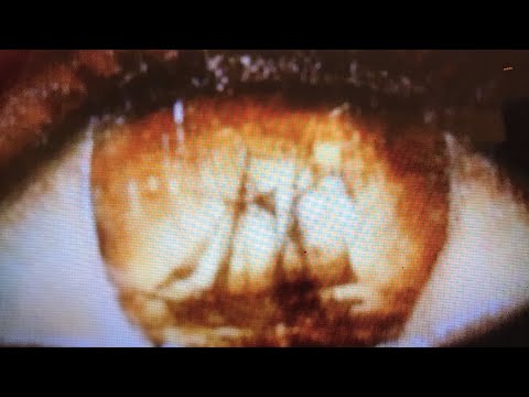 Eyes That See