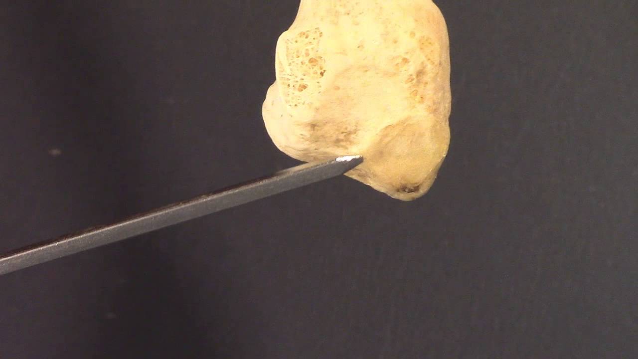 Osseous Anatomy of the Fibula (Advanced)