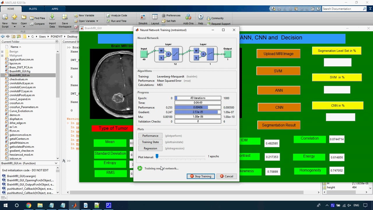 Mri Brain Tumor Detection Using Svm In Matlab Okok Projects Final Year Projects Bangalore
