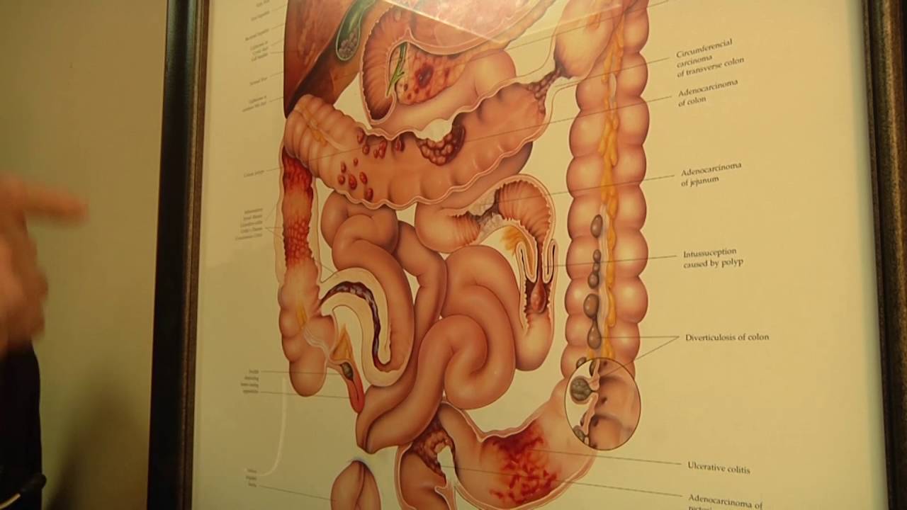 ATRANTIL FOR IBS