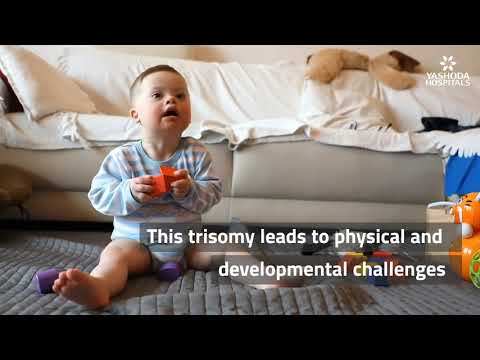 Down Syndrome: Explained in a Minute | Child with Down Syndrome