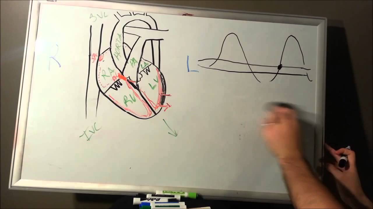 Simple Automaticity of the Heart