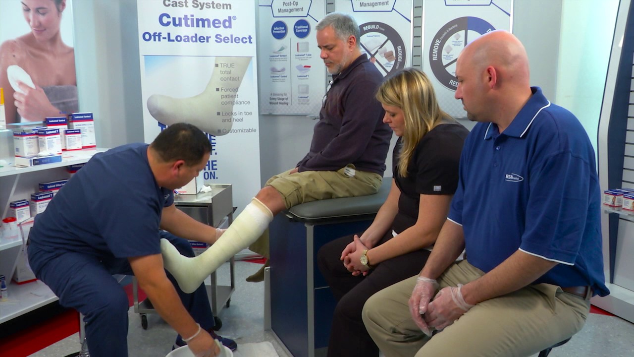How to Prepare, Apply & Remove a Total Contact Cast