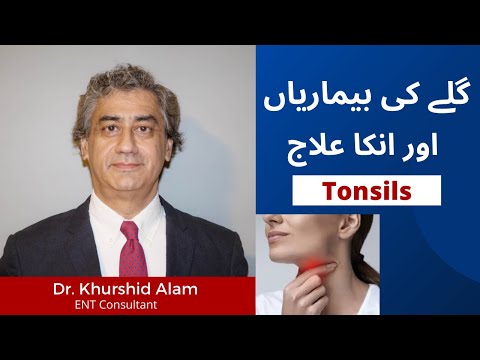 Throat Treatment | Throat pain | Sore throat treatment - Tonsils Dr Khurshid Alam Urdu/Hindi