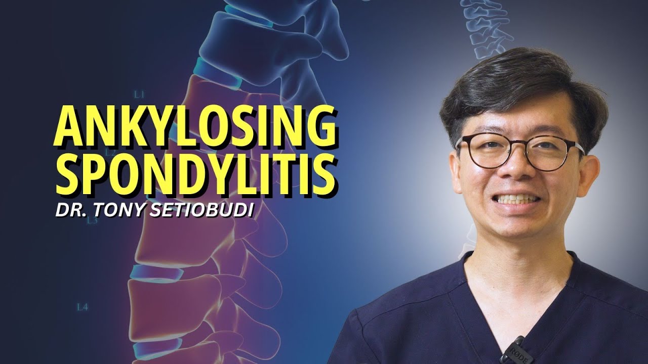 ANKYLOSING SPONDYLITIS 🔴 BAMBOO SPINE | DR. TONY SETIOBUDI