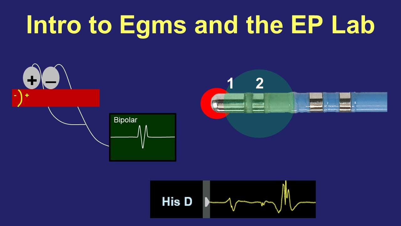 Intro to Intra-cardiac Electrograms & the EP Lab