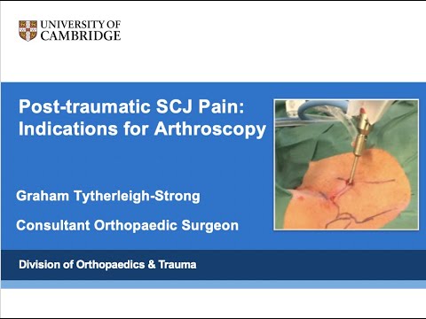 Post-Traumatic Sternoclavicular Pain: Indications for Arthroscopy