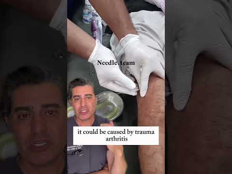 Draining Knee Fluid