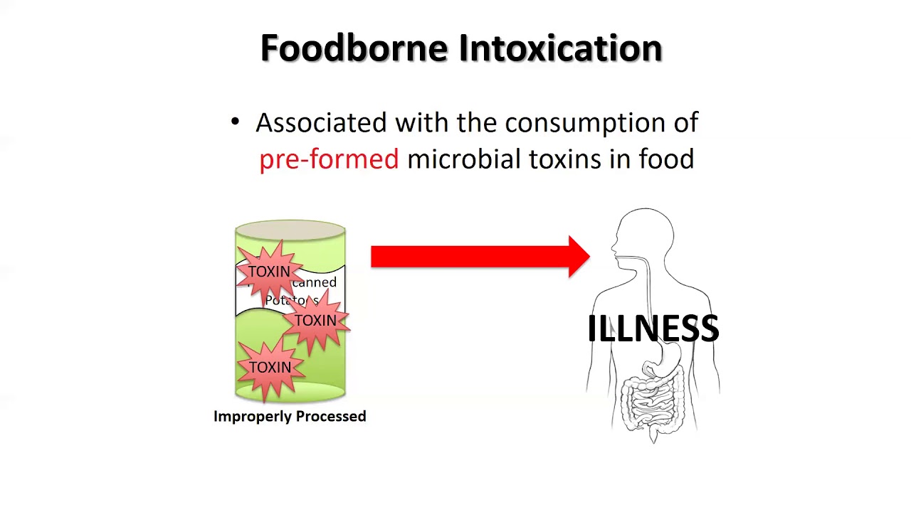 Foodborne Intoxications