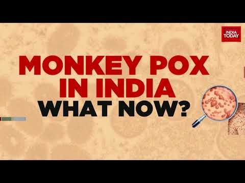 Symptoms Of Monkey Pox, Signs, Treatment & Prevention | Monkey Pox In India
