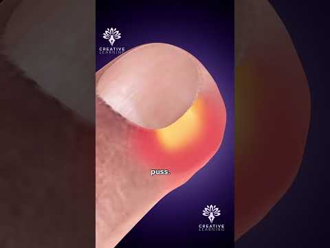 Stop Peeling Hangnails! 😲 #shorts #youtubeshorts - creativelearning3d