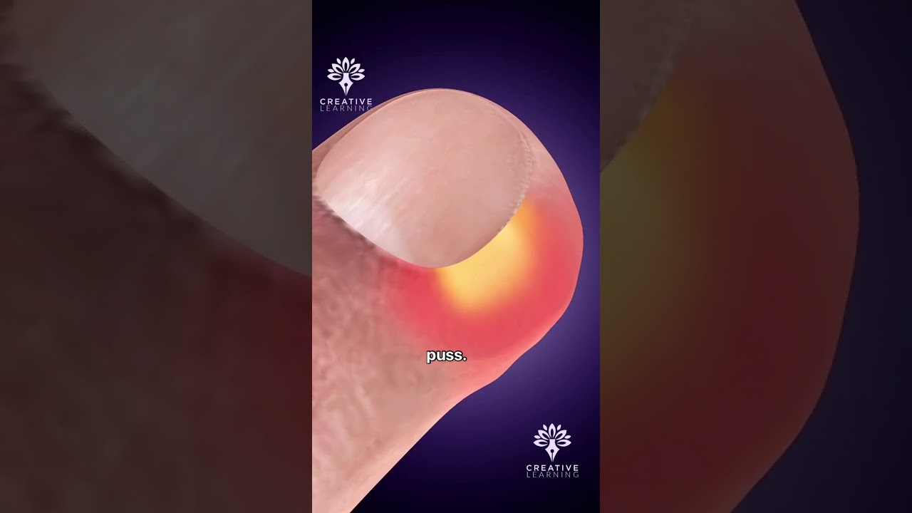 Stop Peeling Hangnails! 😲 #shorts #youtubeshorts - creativelearning3d