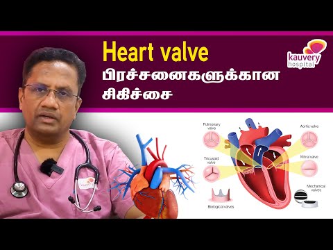 Treatment for heart valve problems | இதய வால்வு பிரச்சனைகளுக்கான சிகிச்சை