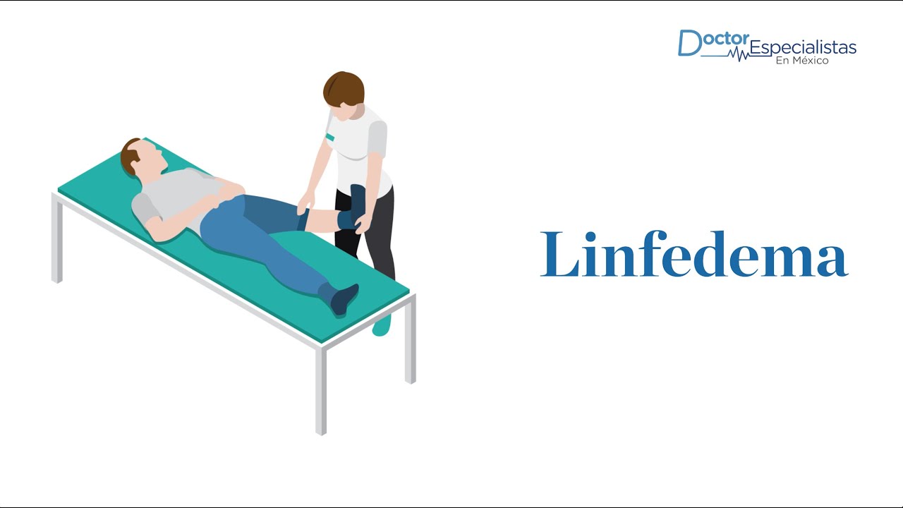Linfedema (Fisioterapia) - Doctor Especialistas