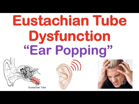 Eustachian Tube Dysfunction (“Popping Sound in Ears”) | Causes, Symptoms, Diagnosis, Treatment