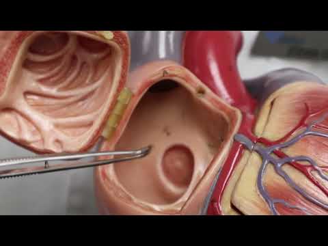 Internal Feature of Right Atrium