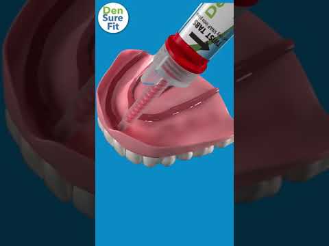 Make Your Dentures Fit Perfectly Again With This Revolutionary Innovation