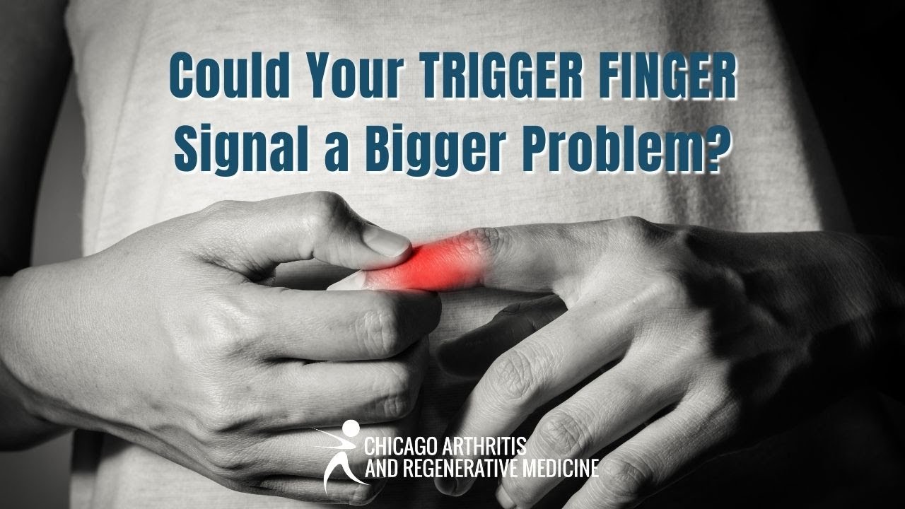 Could Your Trigger Finger Signal a Bigger Problem? - Chicago Arthritis ...