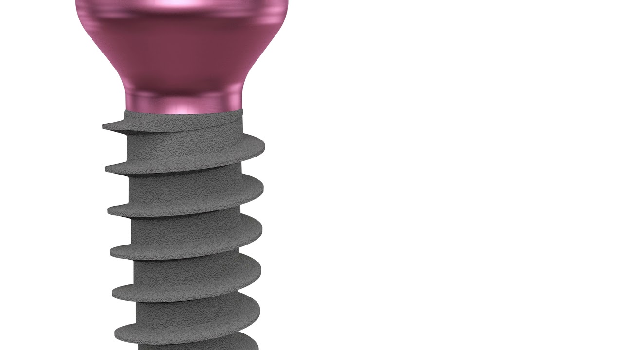 Compressive MP. Overview.