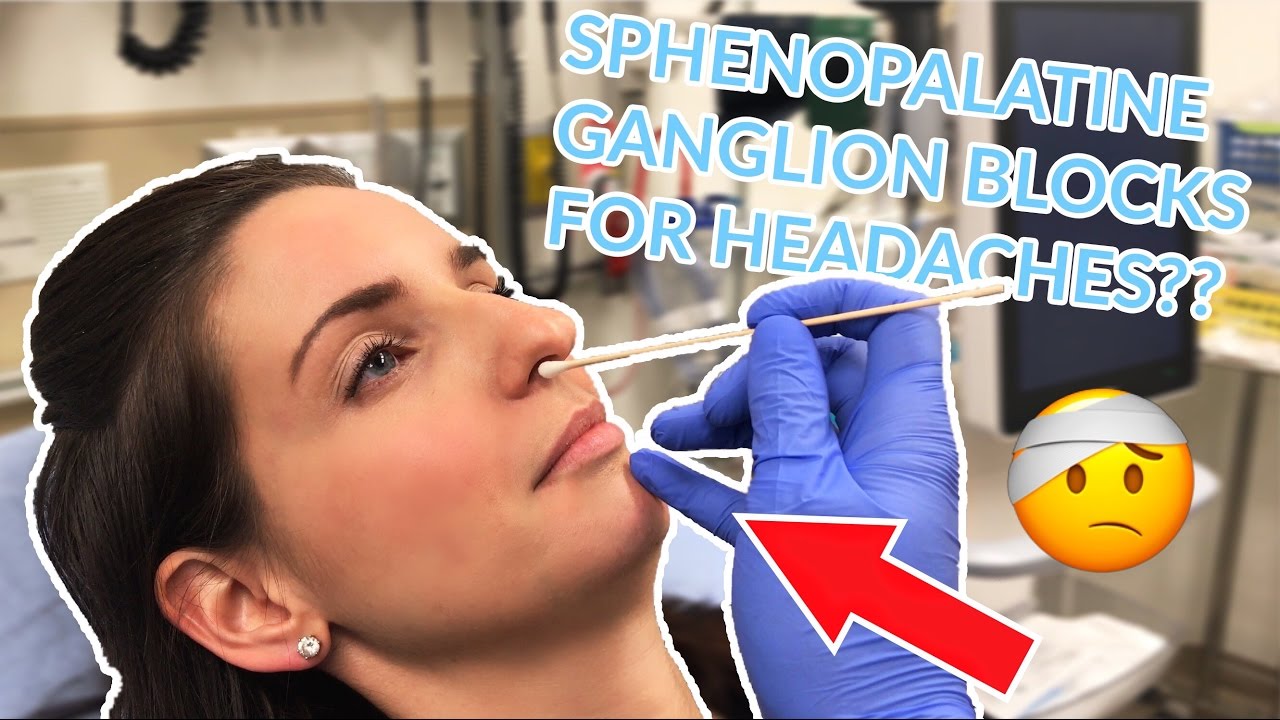 Sphenopalatine Ganglion Block for Treatment of Headaches