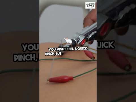 Step-by-Step EMG Testing for Nerve Damage - Unlocking Nerve Health | EMG Testing Guide