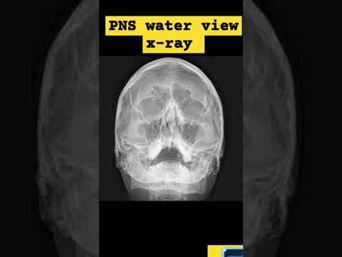 PNS water view x ray ☢️ #radiology #anatomy #ortho #osteology #physiology #mbbs #neet #trending #ct